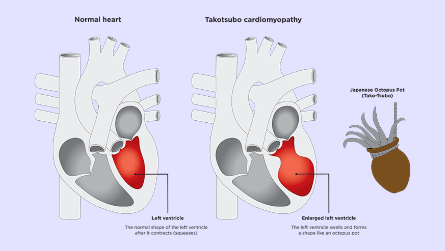 Can you die from a broken heart? - Leora Healthcare